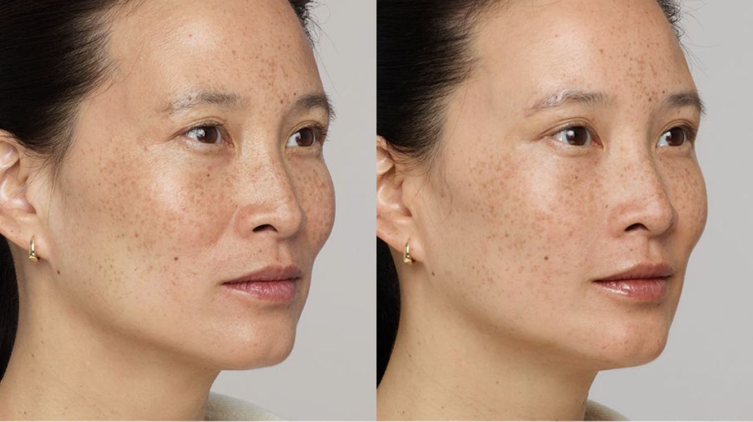 RENEWAL +++EGF SERUM / Functional Hydration & Repair – RMÈD by GOODSKIN